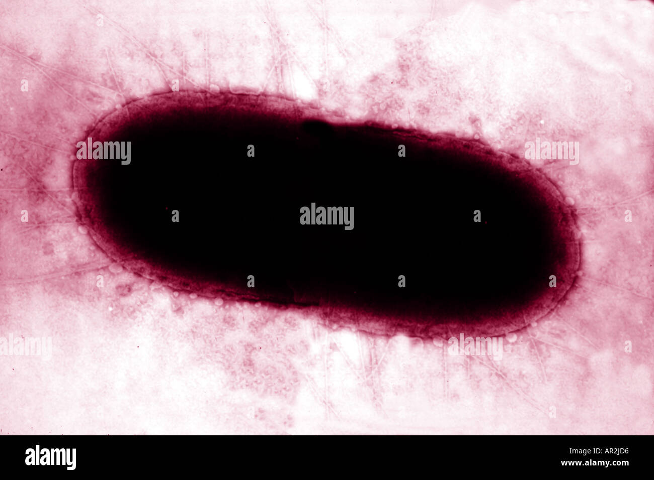 Toxigenic coli hi-res stock photography and images - Alamy