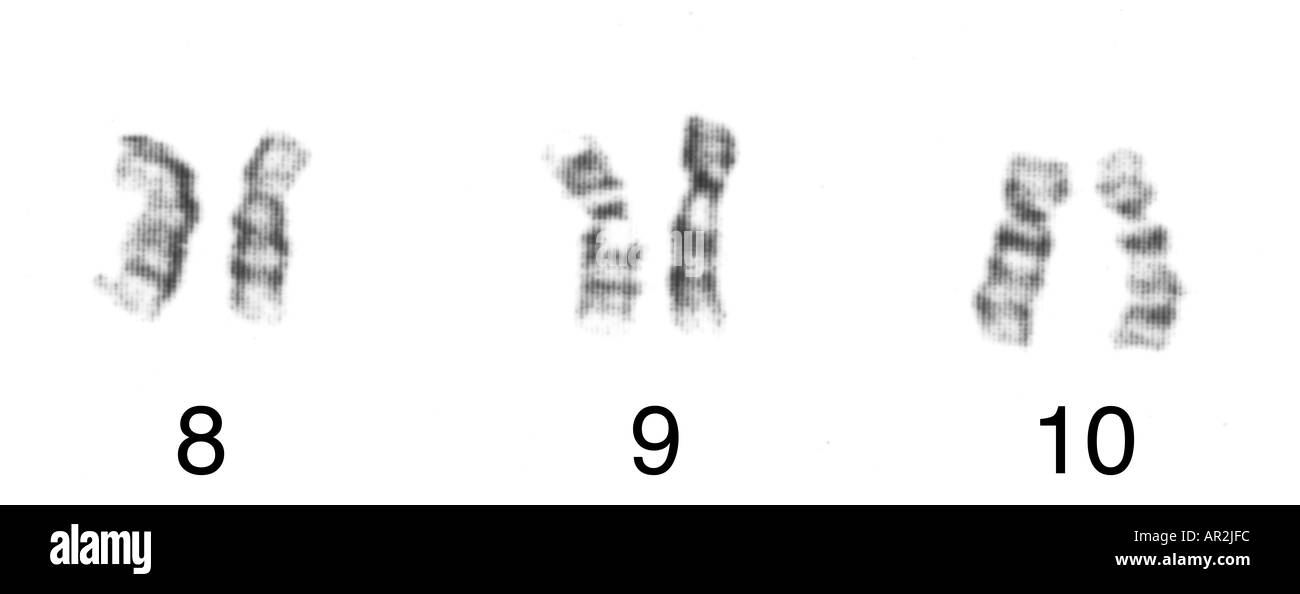 chromosomes 8 9 and 10 stained to show the banding patterns Stock Photo ...