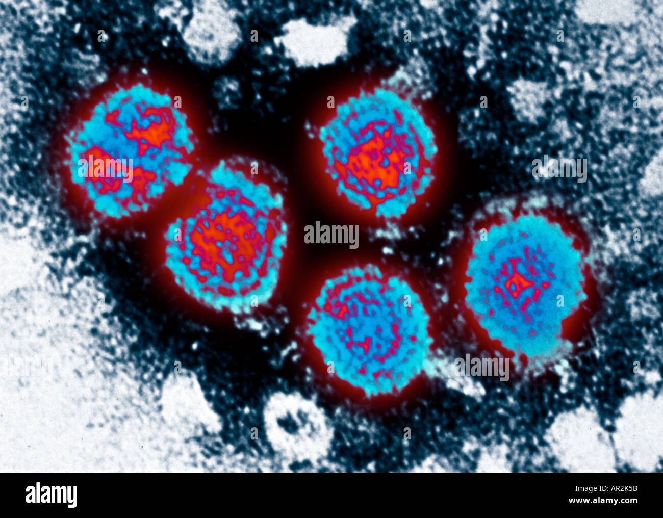 electron microscope image of hepatitis B Dane particles Computer ...