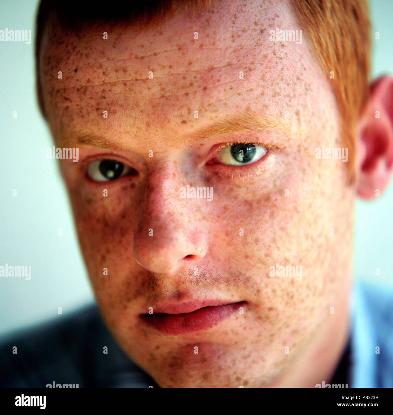 Young man with freckles Stock Photo - Alamy