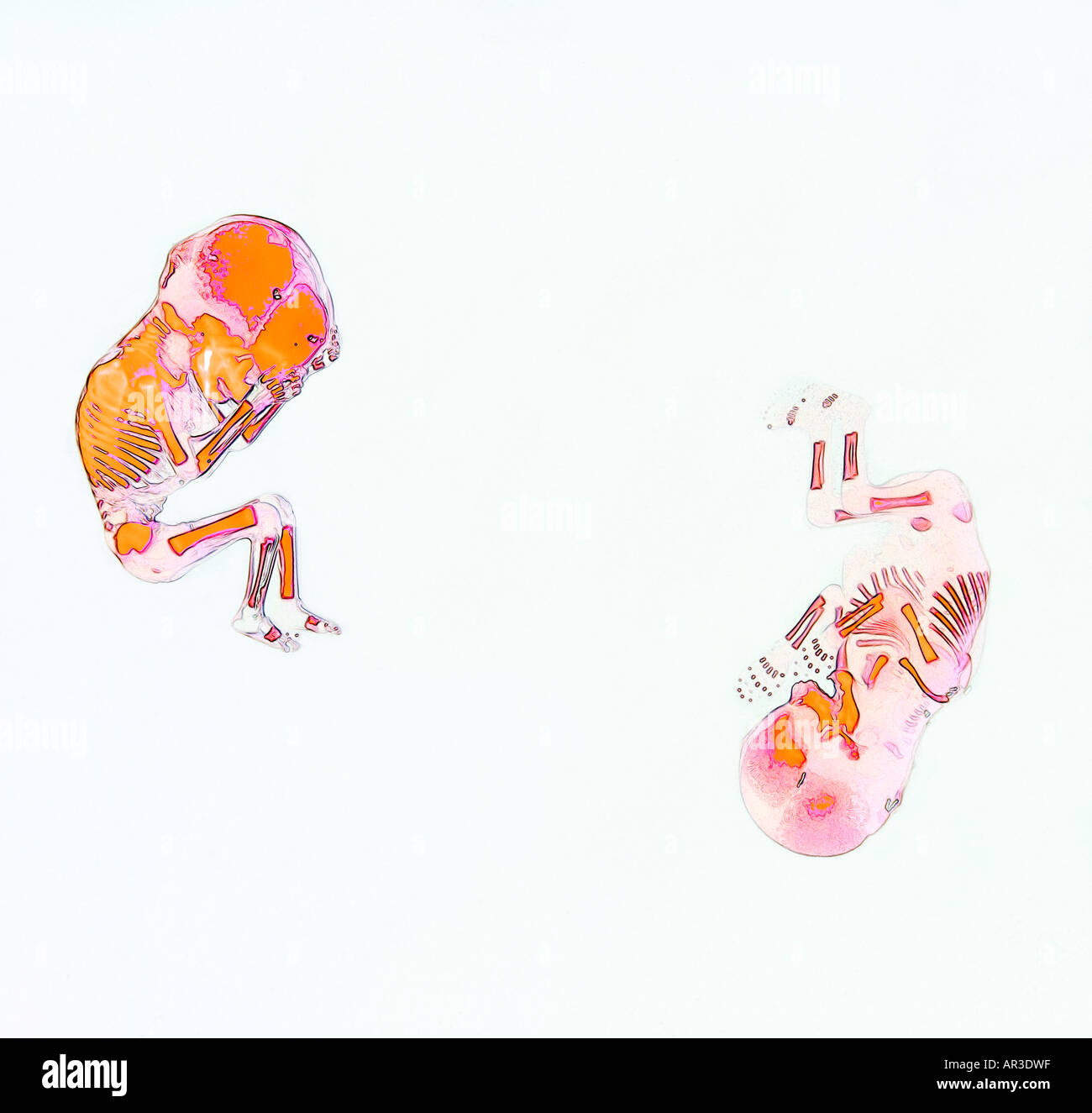 Fetus human not illustration Cut Out Stock Images & Pictures - Alamy