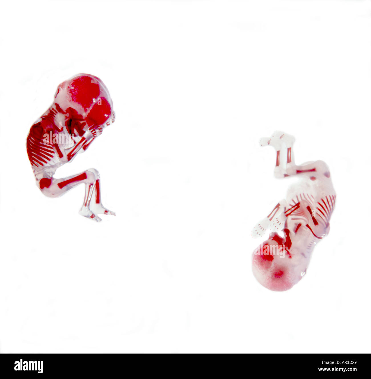 Fetus human not illustration Cut Out Stock Images & Pictures - Alamy