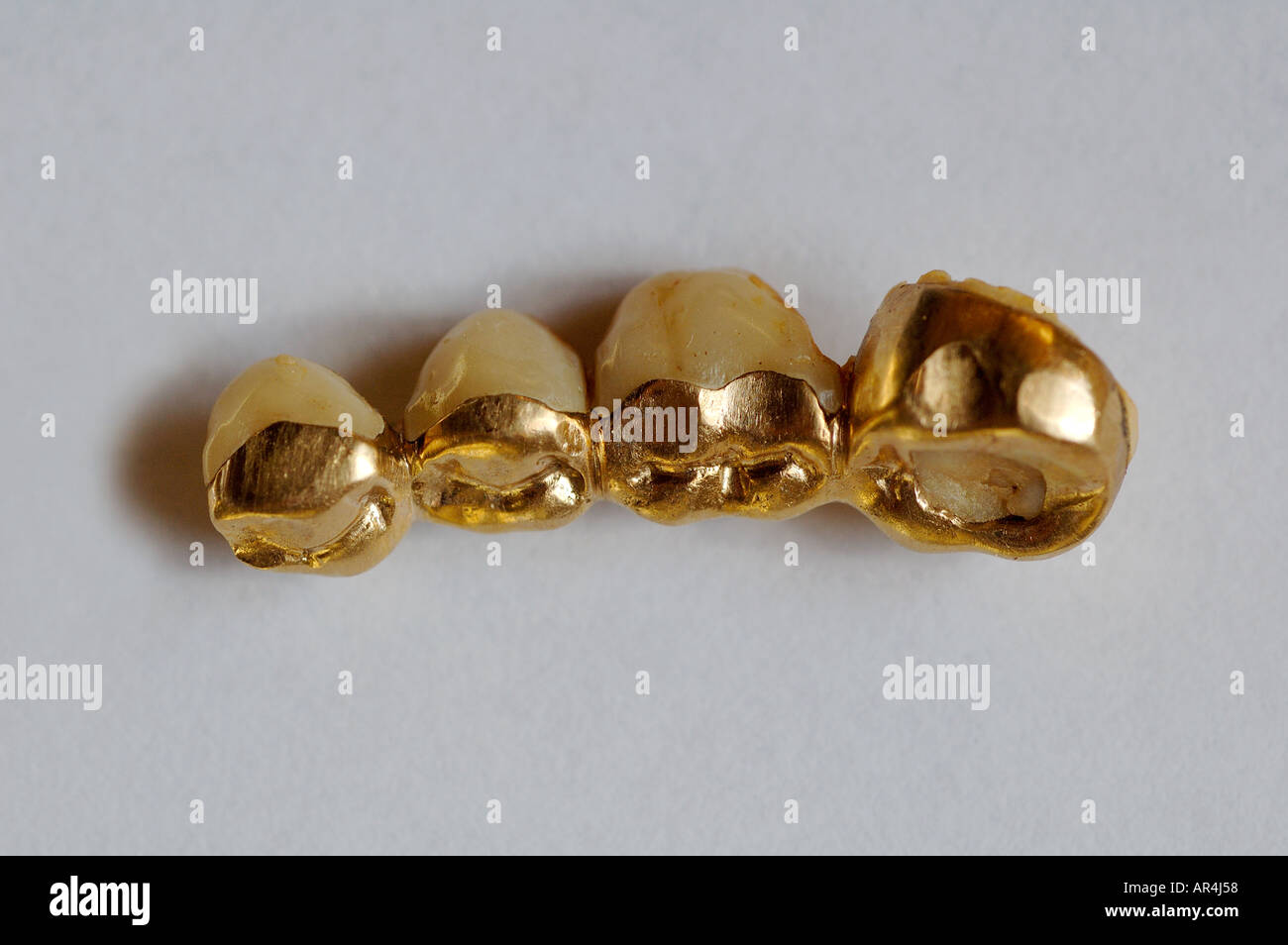 Gold Tooth High Resolution Stock Photography and Images - Alamy