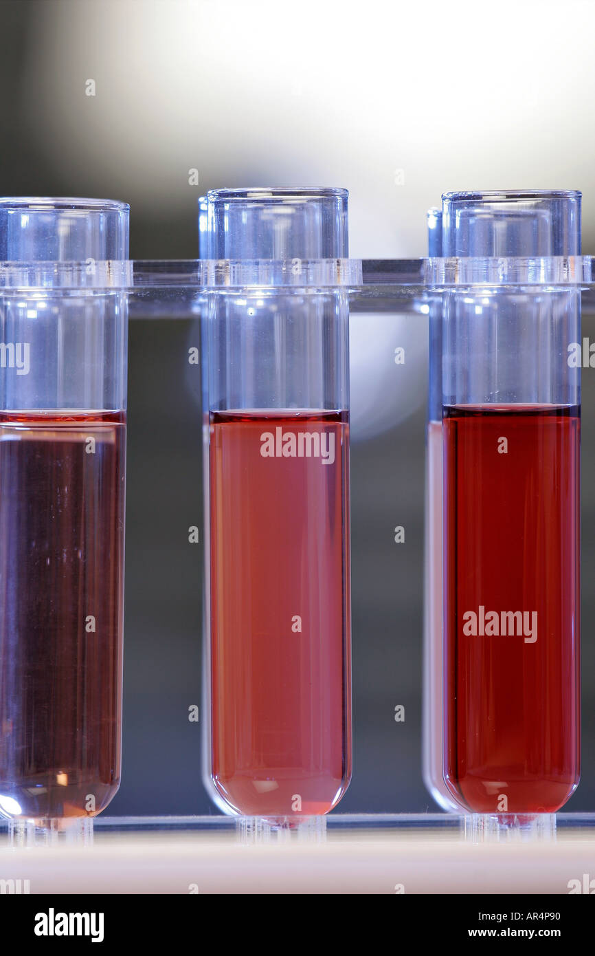Blood culture tubes hi-res stock photography and images - Alamy