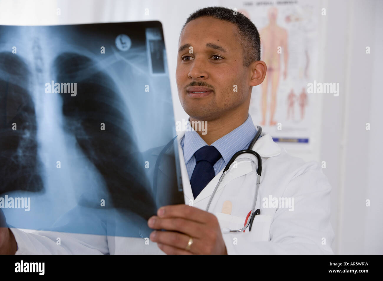African doctor looking at x-ray Stock Photo - Alamy