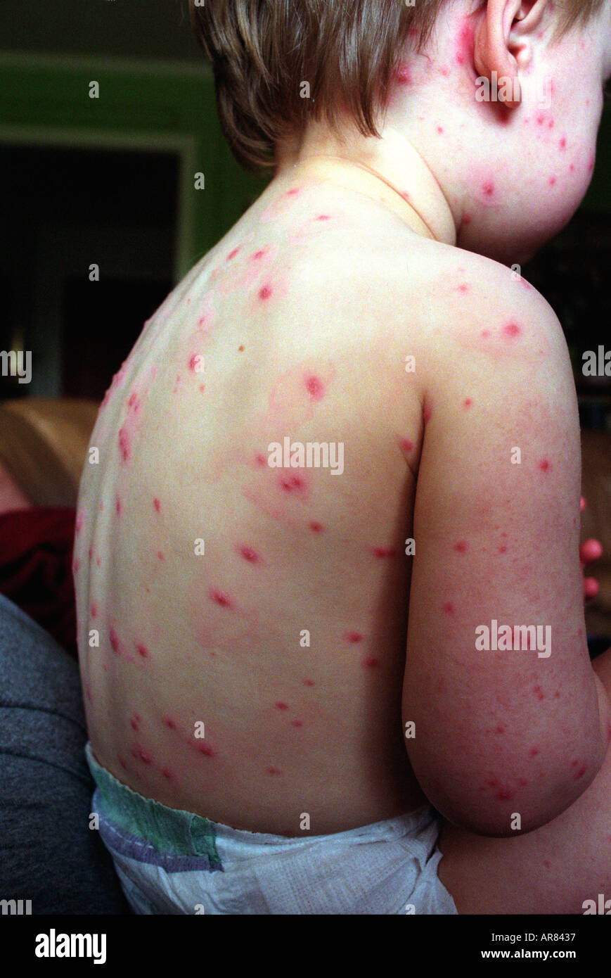 Morbillivirus High Resolution Stock Photography and Images - Alamy