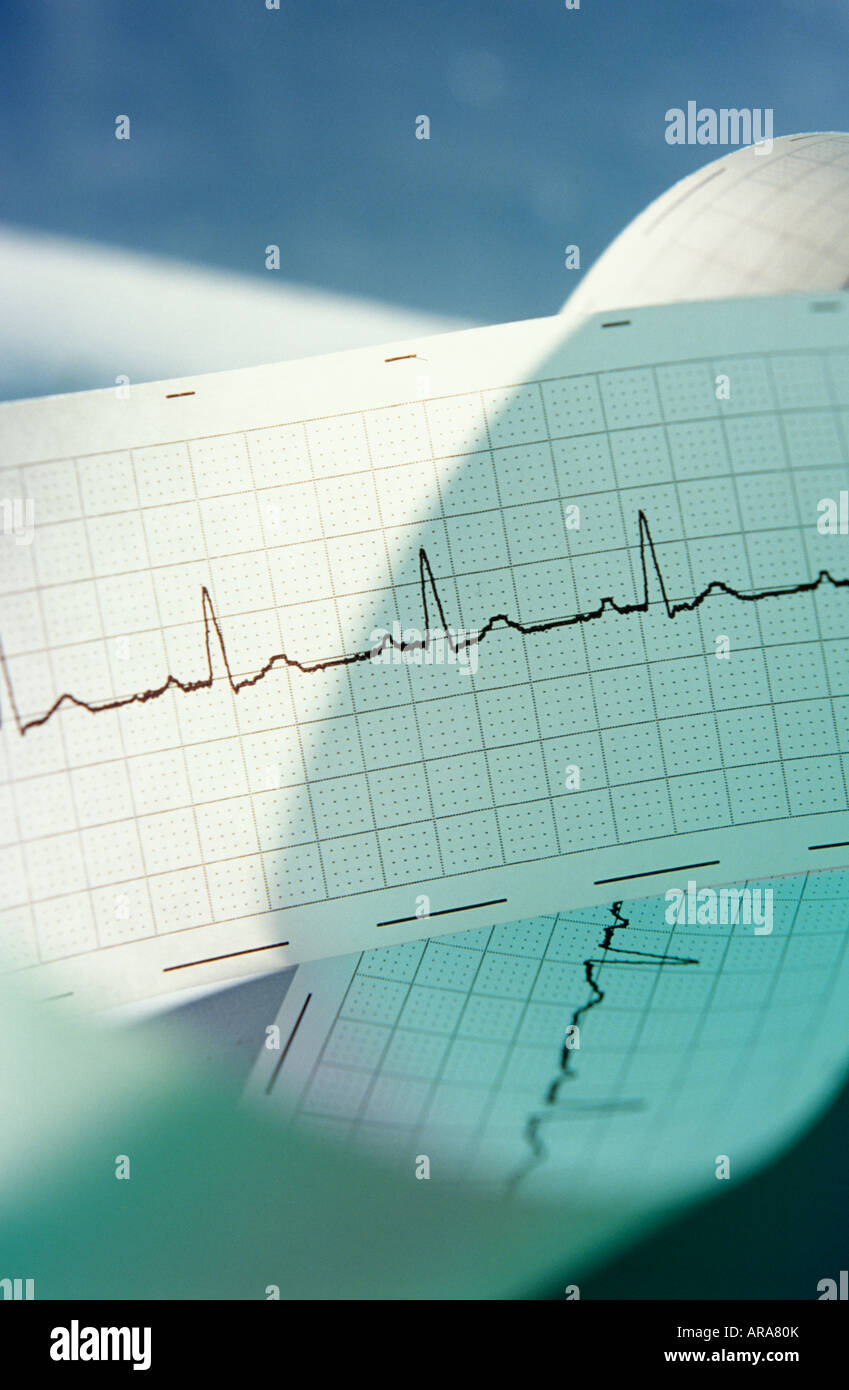 Ecg print out hi-res stock photography and images - Alamy
