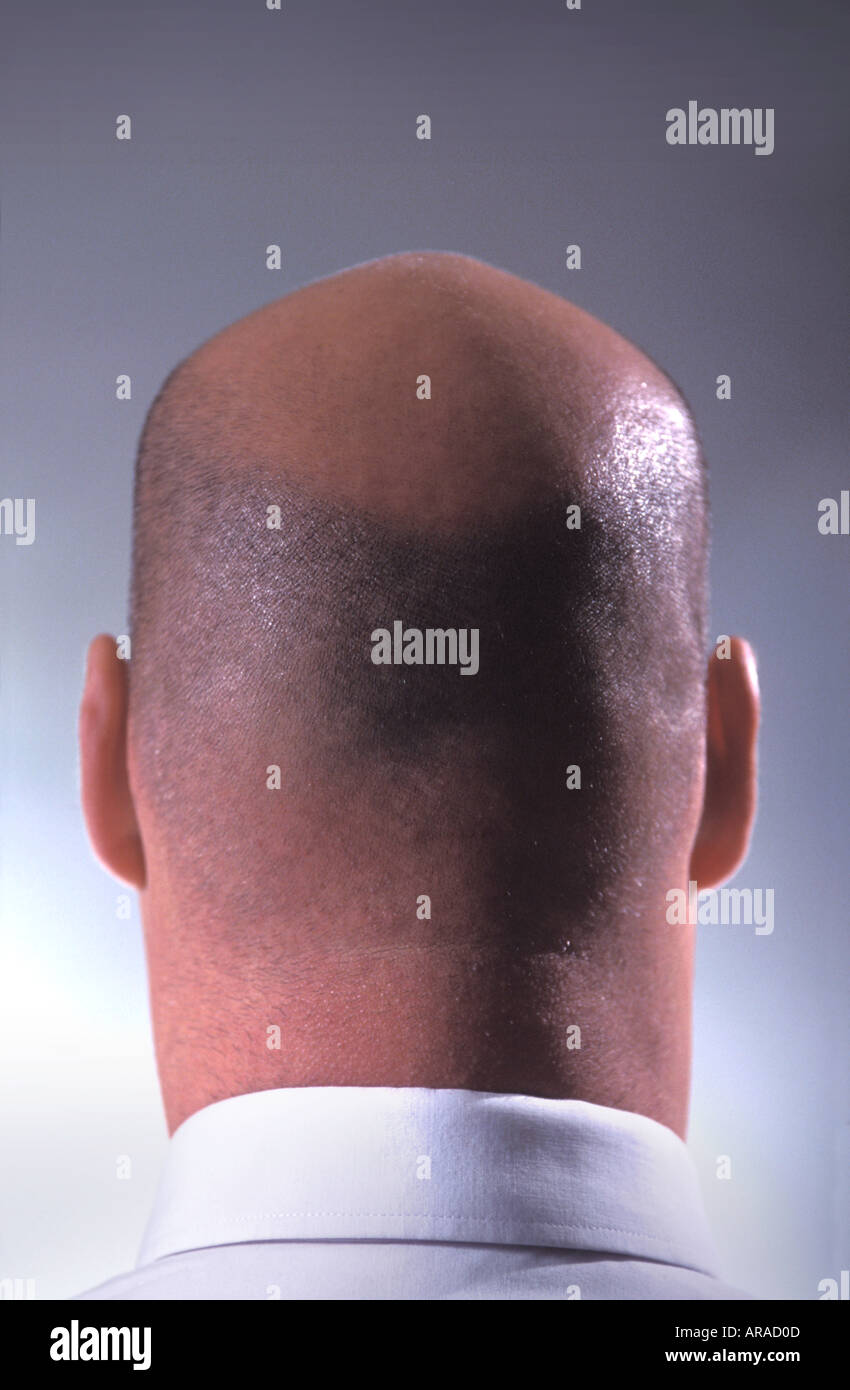BALD HEADED MAN Stock Photo - Alamy