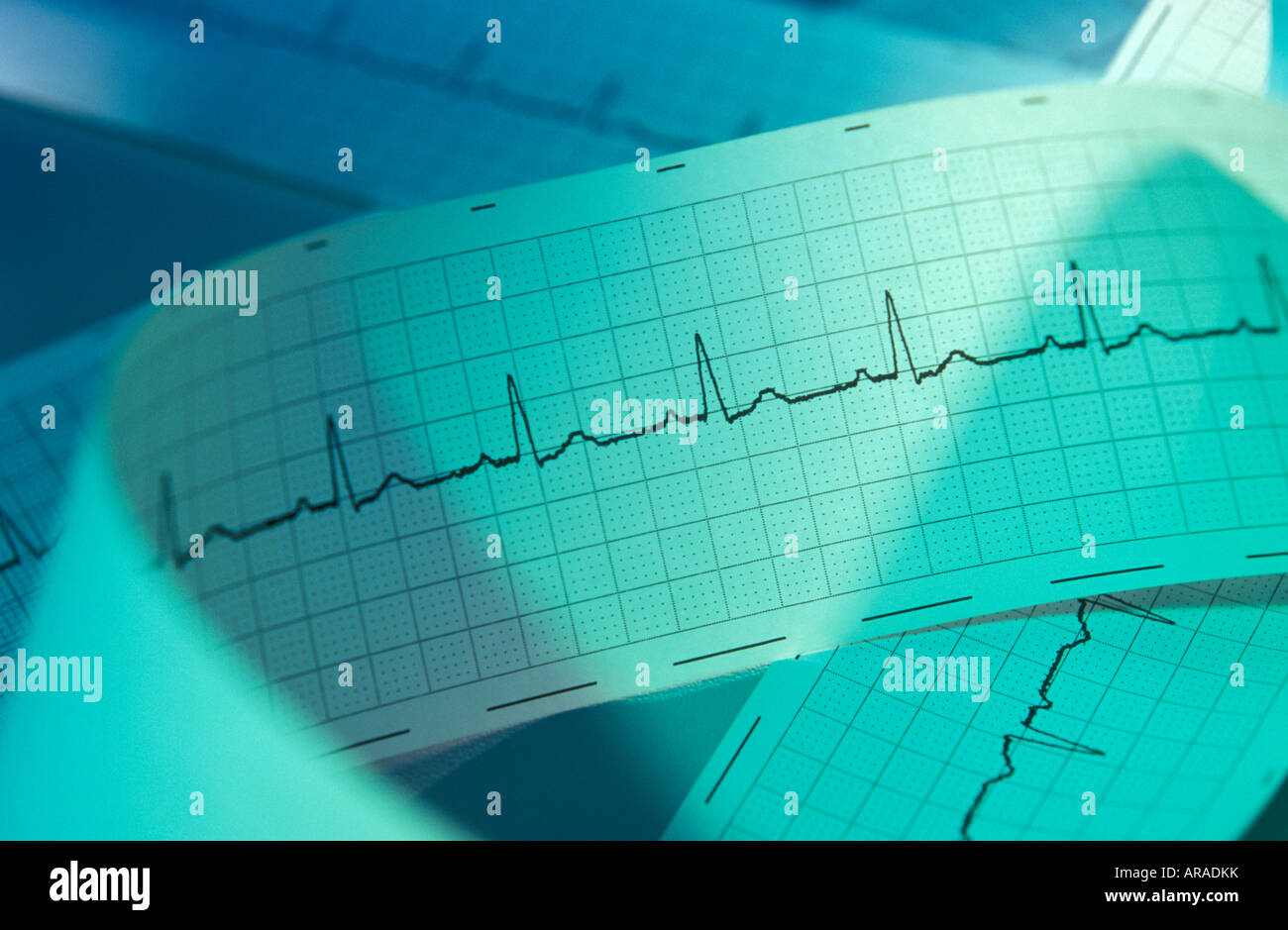 Ecg print out hi-res stock photography and images - Alamy