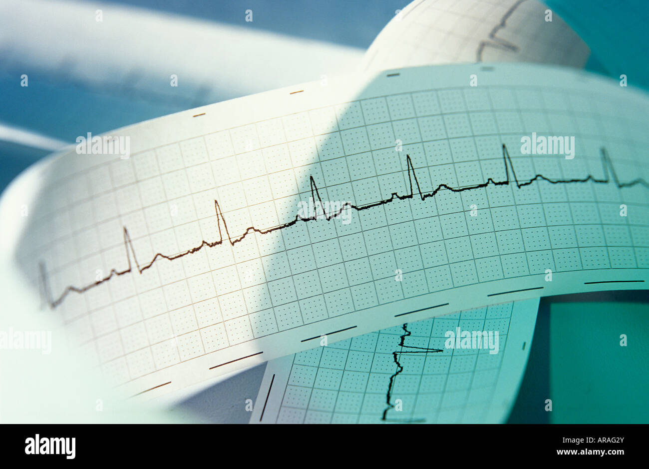 ECG Stock Photo - Alamy