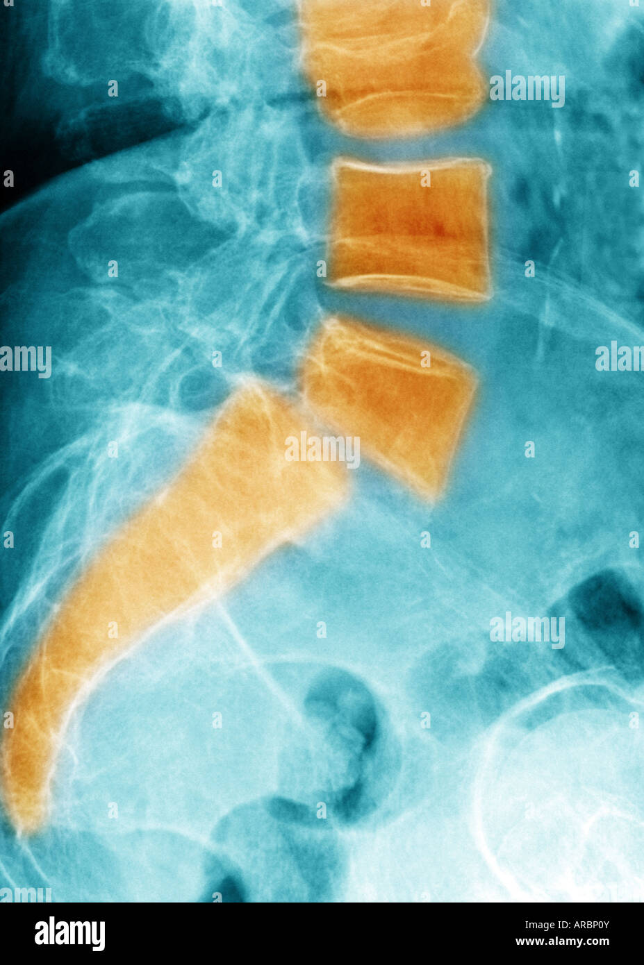 L5 s1 hi-res stock photography and images - Alamy