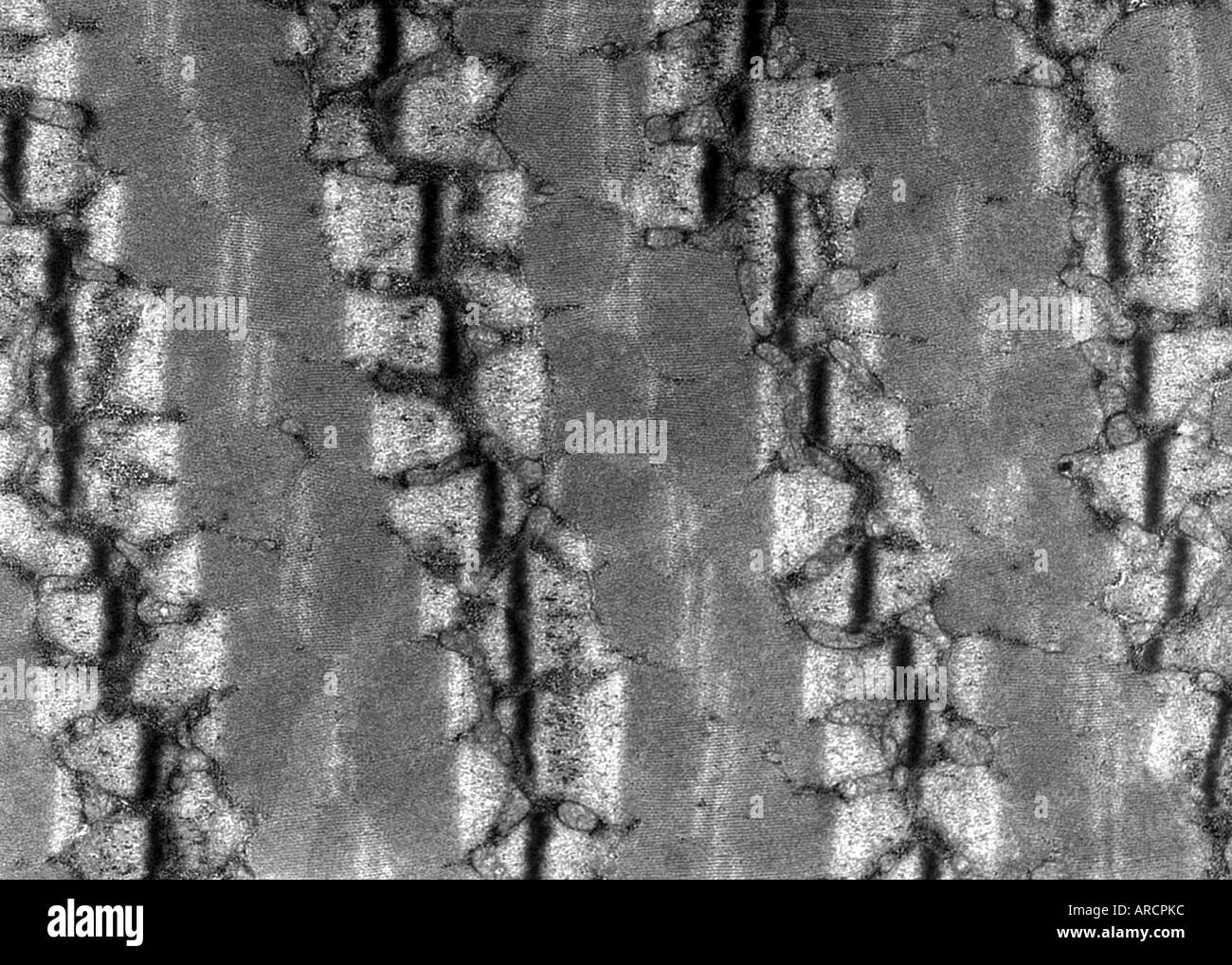 Skeletal striated muscle tissue High Resolution Stock Photography and Images - Alamy