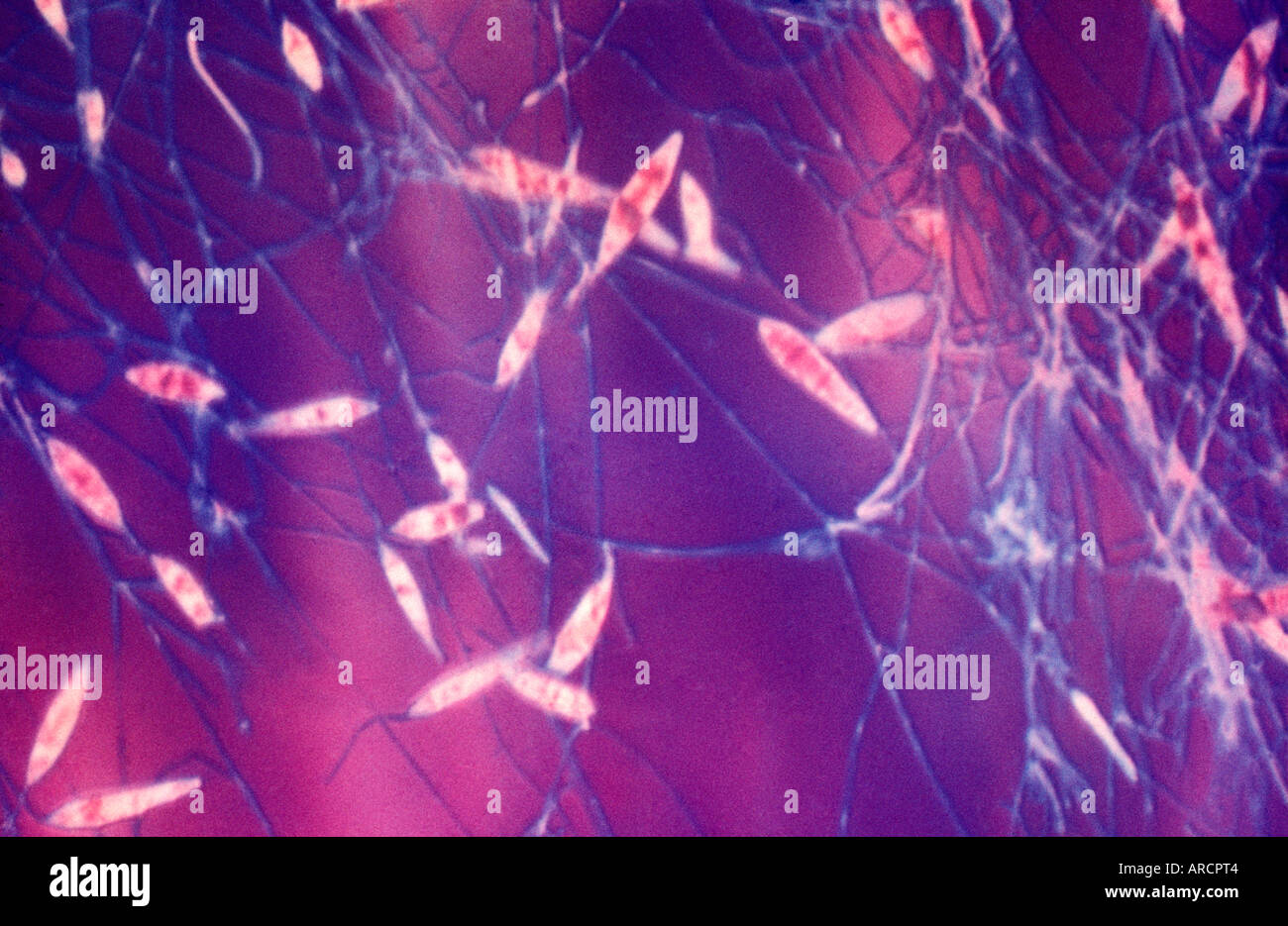 A dermatophyte is a parasitic fungus of the skin Stock Photo - Alamy