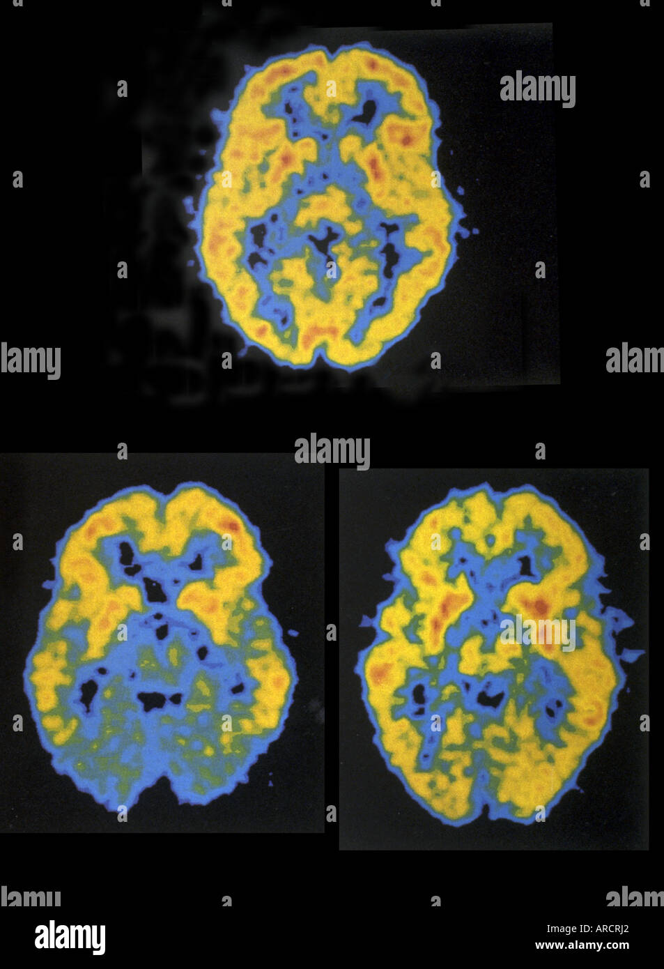 Human pet scans hi-res stock photography and images - Alamy
