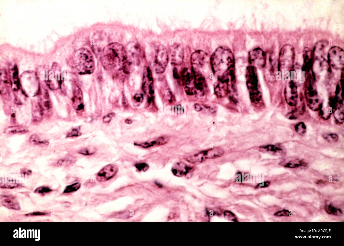 A photomicrograph showing ciliated columnar epithelium of the uterine ... A photomicrograph showing ciliated columnar epithelium of the uterine ...