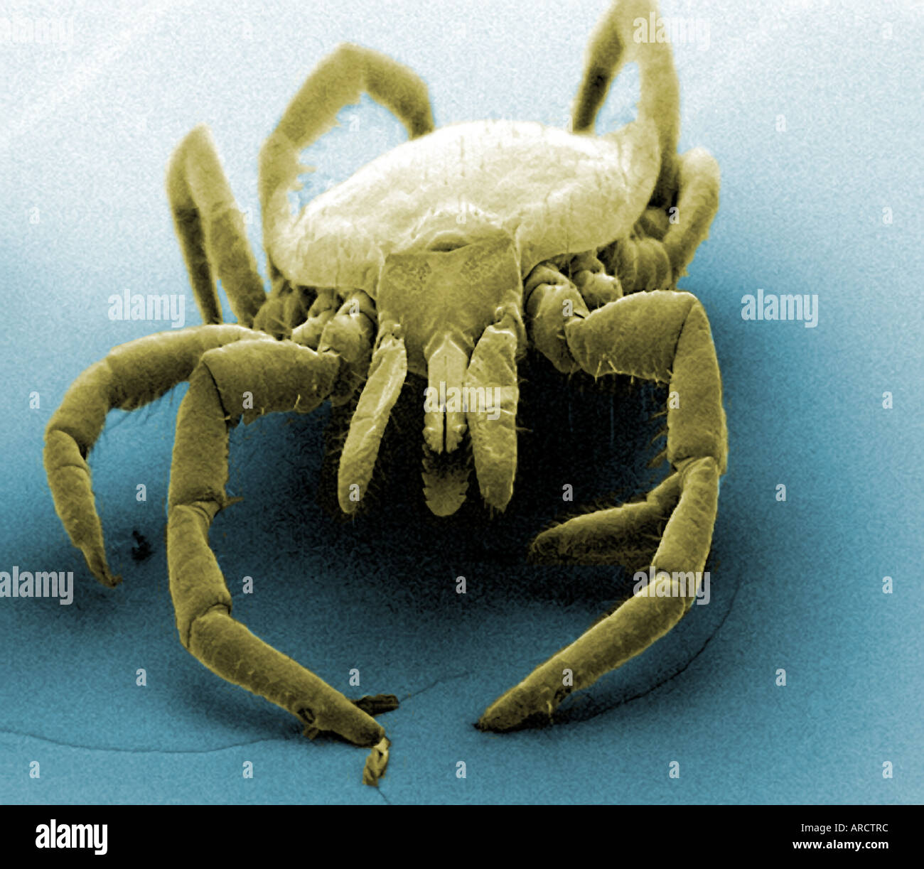 Scanning electron micrograph tick hi-res stock photography and images ...