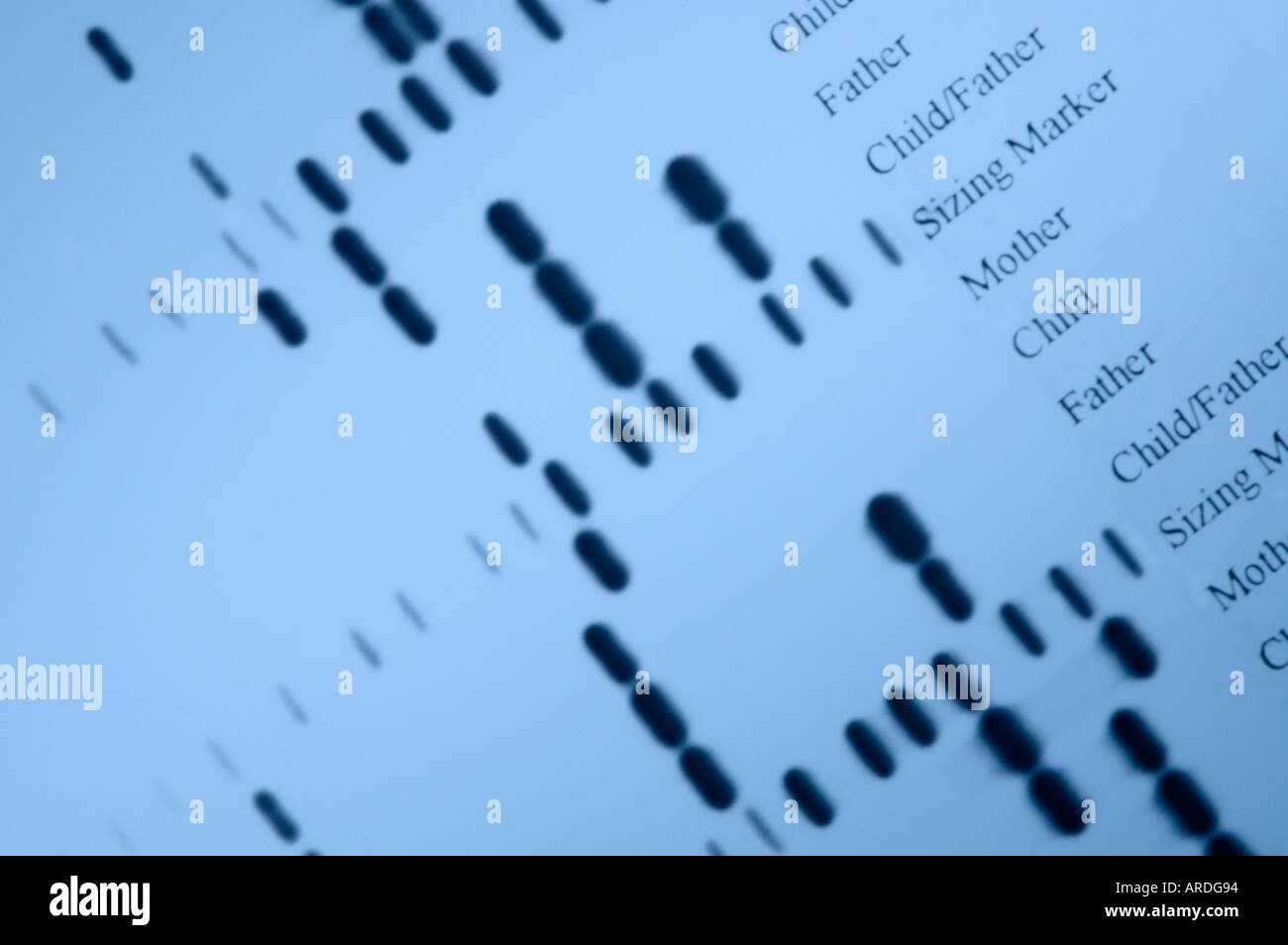 Autoradiograph of "DNA fingerprints" from paternity determination ...