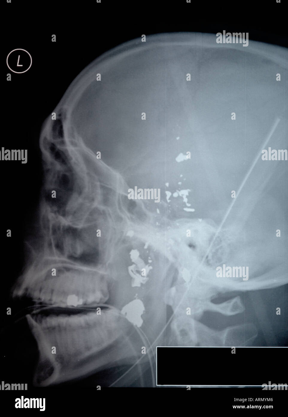 Gsw xray hi-res stock photography and images - Alamy