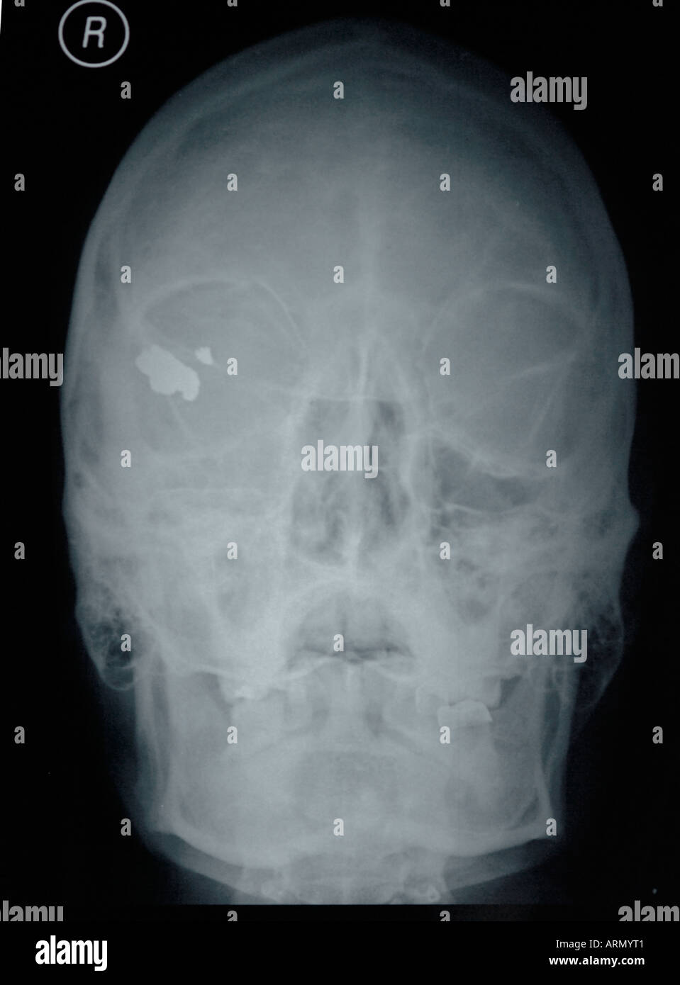 Gsw xray hi-res stock photography and images - Alamy