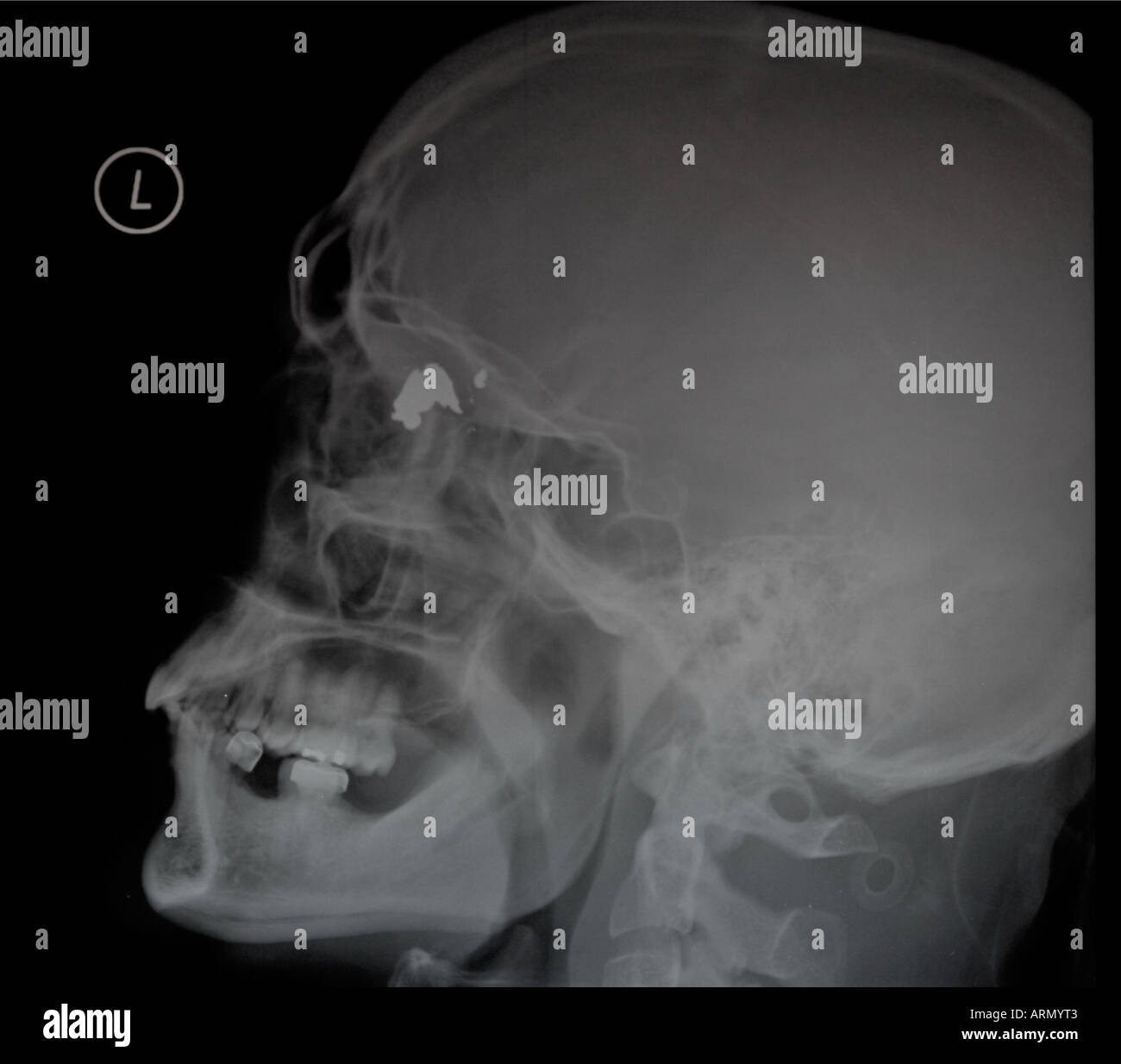 Gsw xray hi-res stock photography and images - Alamy