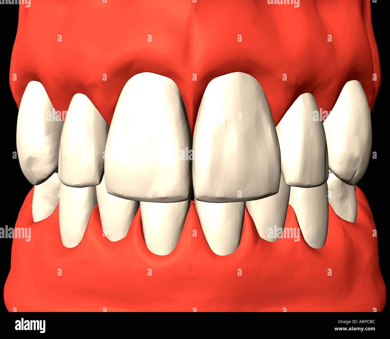teeth with gums Stock Photo - Alamy