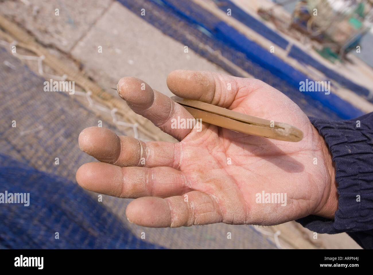 Fisherman shows his sore hand Stock Photo - Alamy