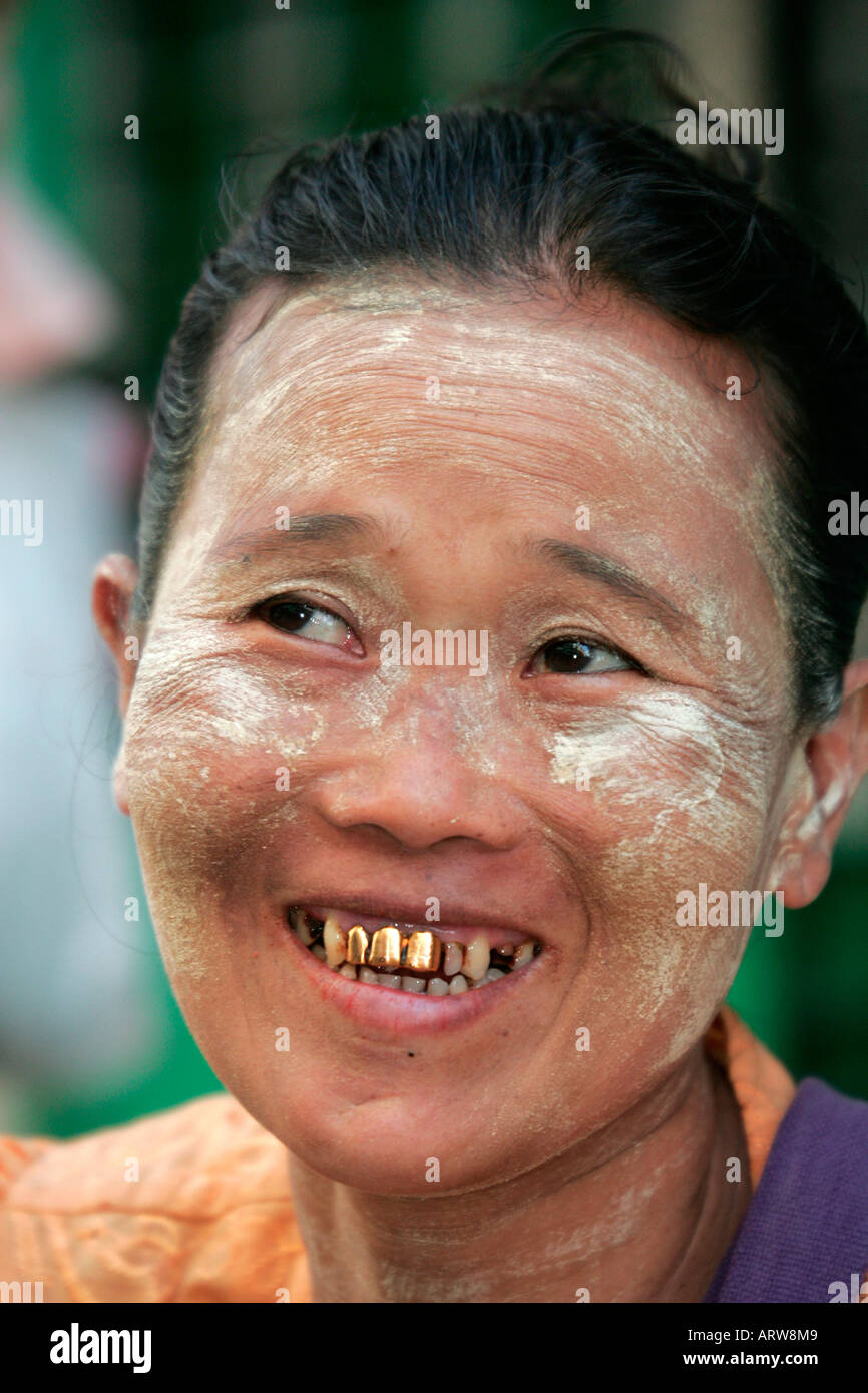 Gold teeth hi-res stock photography and images - Alamy