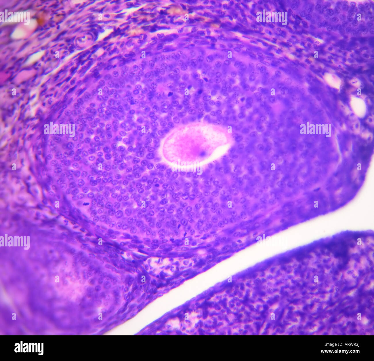 Primary follicle hi-res stock photography and images - Alamy
