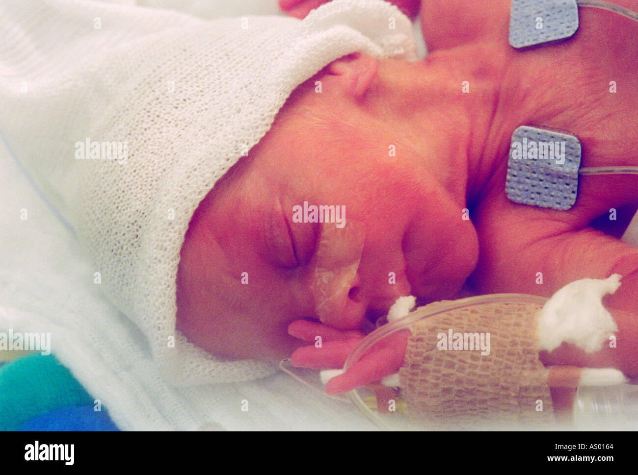 Neonate incubator hi-res stock photography and images - Alamy