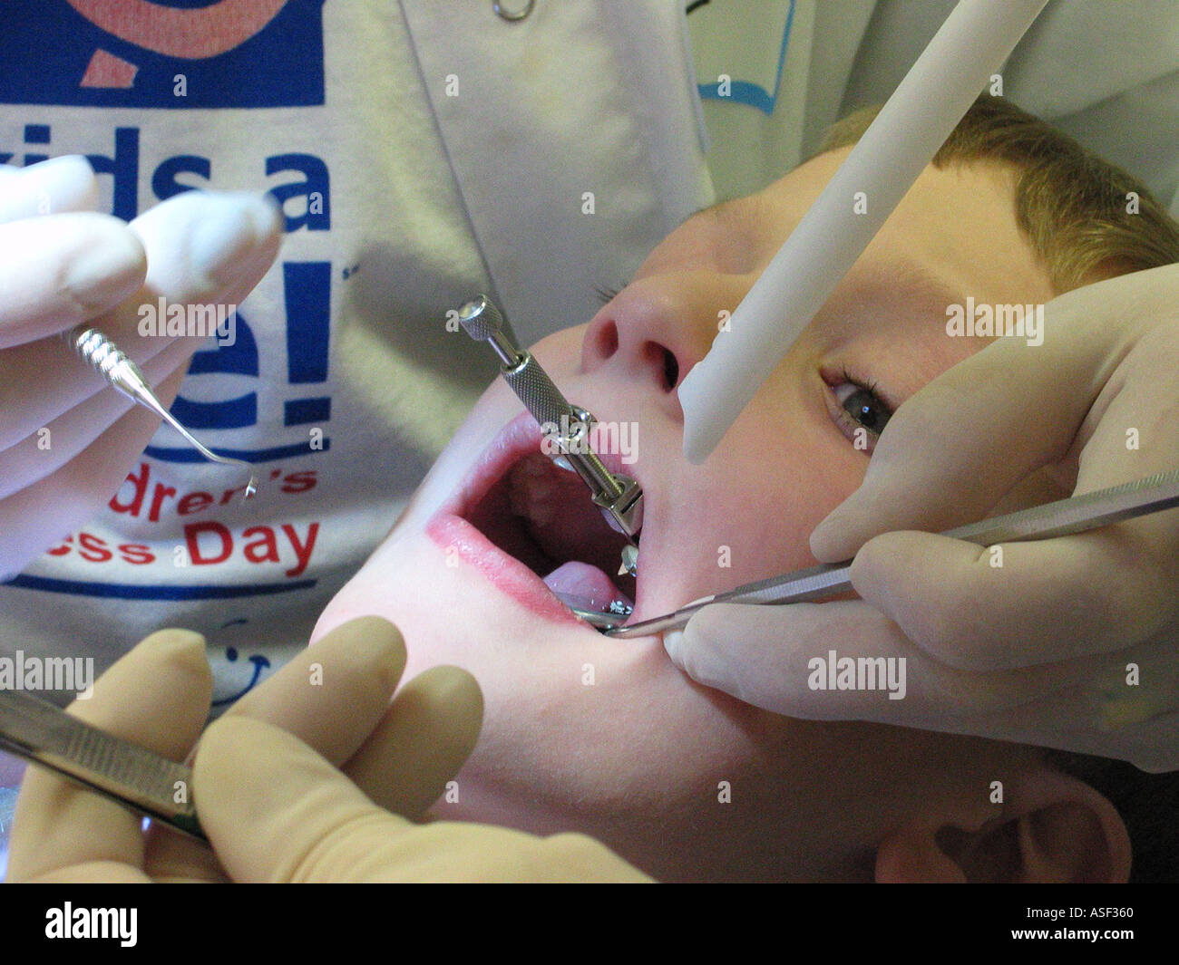 Low income child gets free dental treatment Stock Photo - Alamy