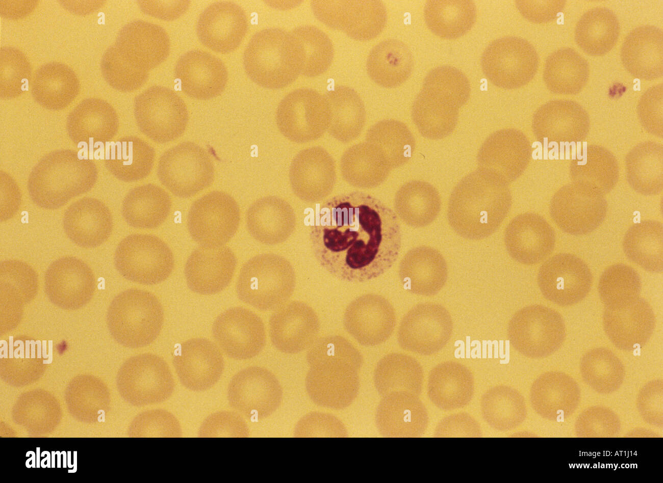 Neutrophil micrograph hi-res stock photography and images - Alamy