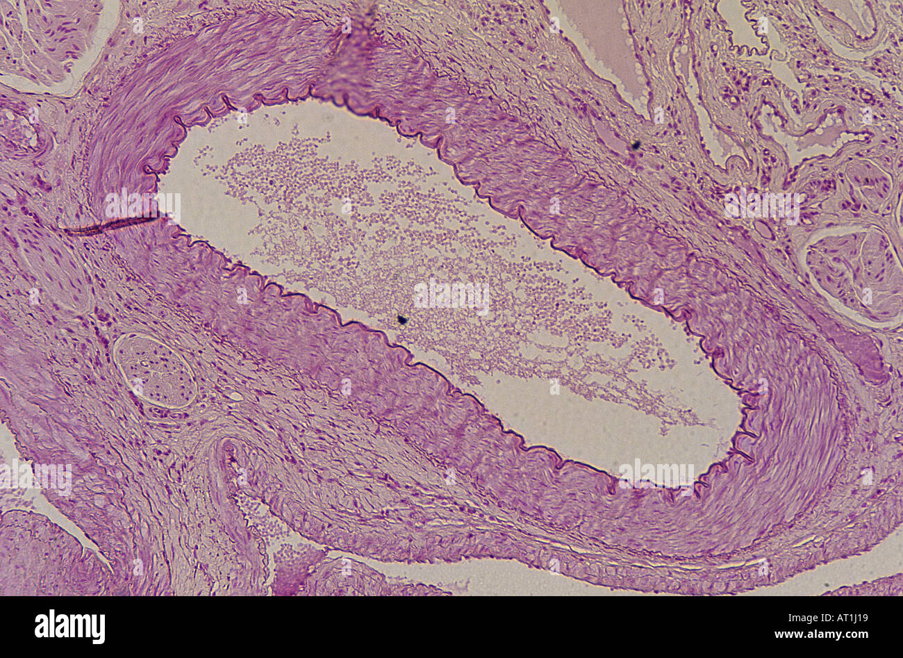 Venule Blood vessel Circulatory tissue 35x Stock Photo - Alamy