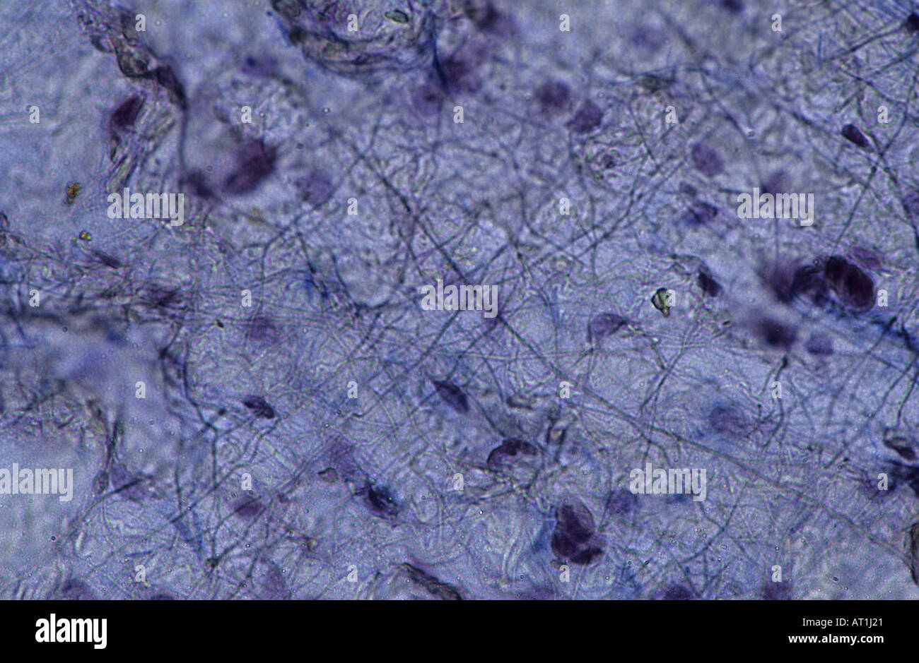 Tejido conjuntivo laxo hi-res stock photography and images - Alamy