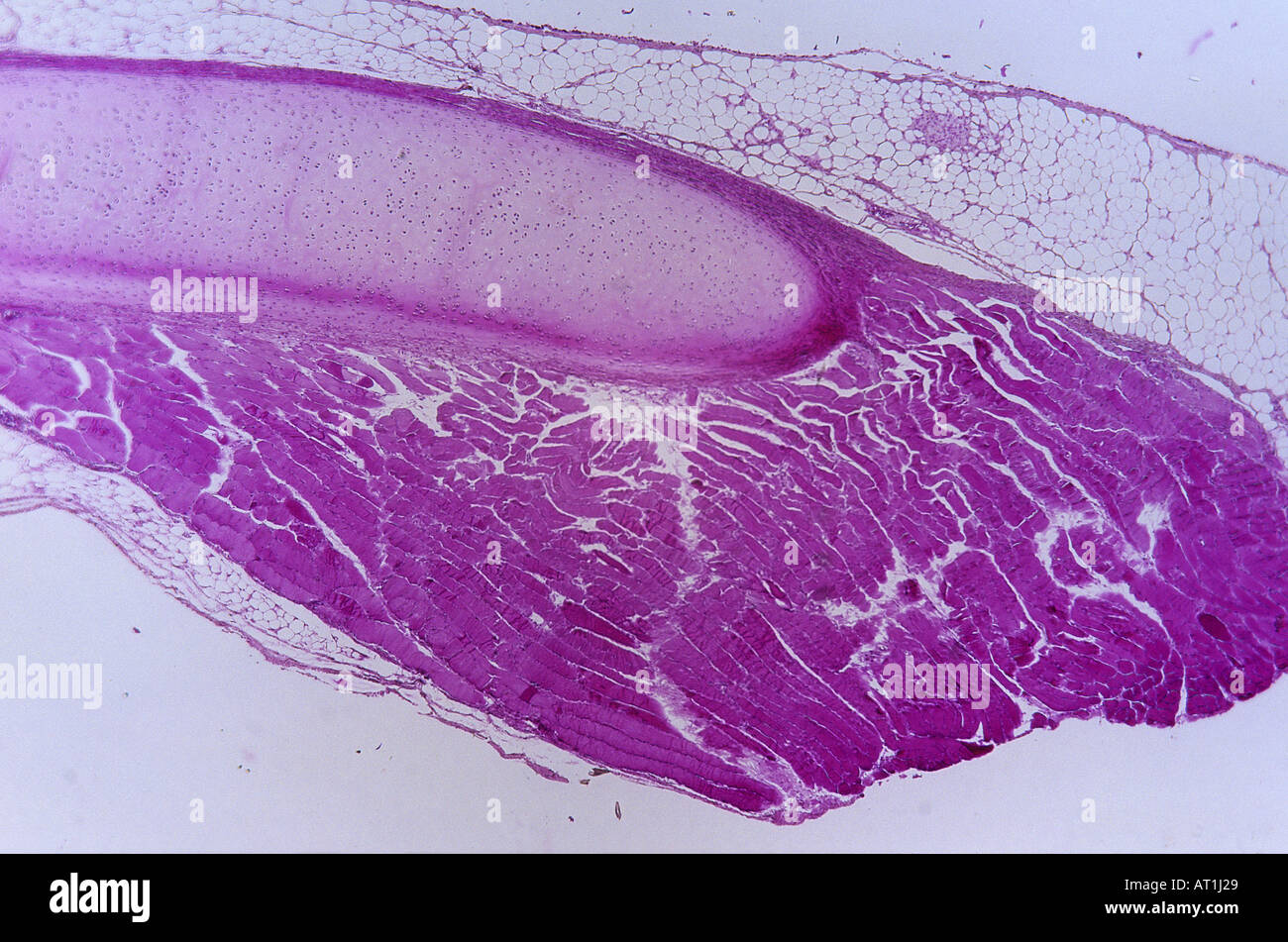 Hyaline cartilage hi-res stock photography and images - Alamy