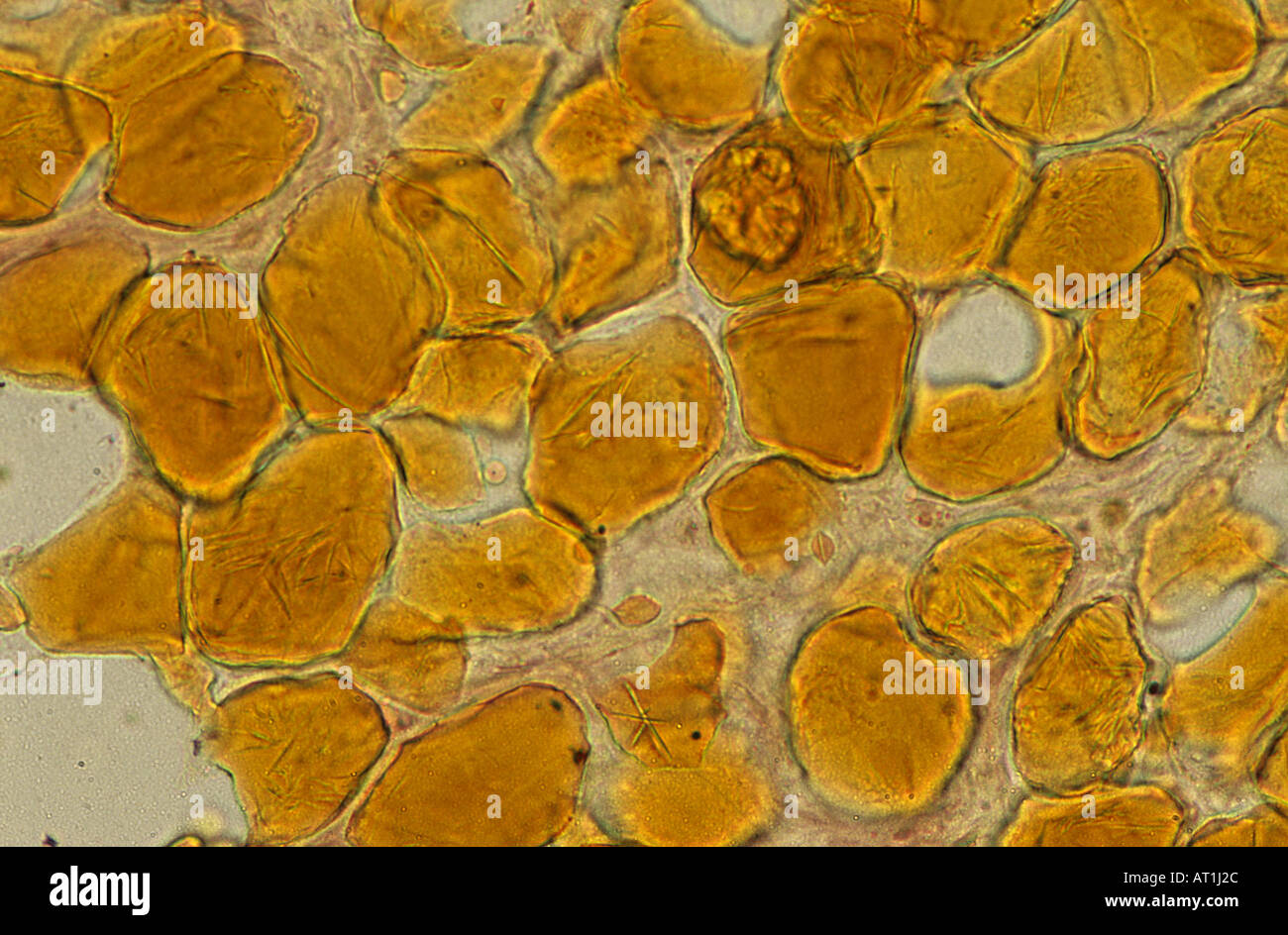 Adipose tissues hi-res stock photography and images - Alamy