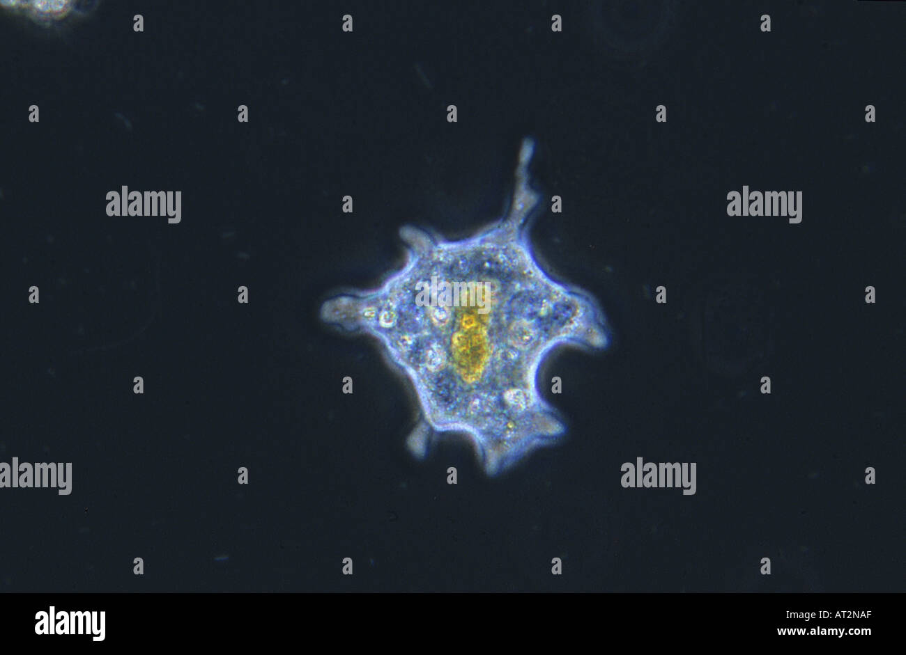 Amoeba Rhizopoda Protozoans Optic microscopy Stock Photo - Alamy