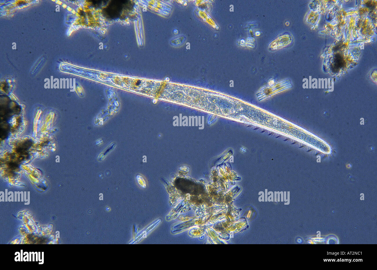 Spirostomum hi-res stock photography and images - Alamy