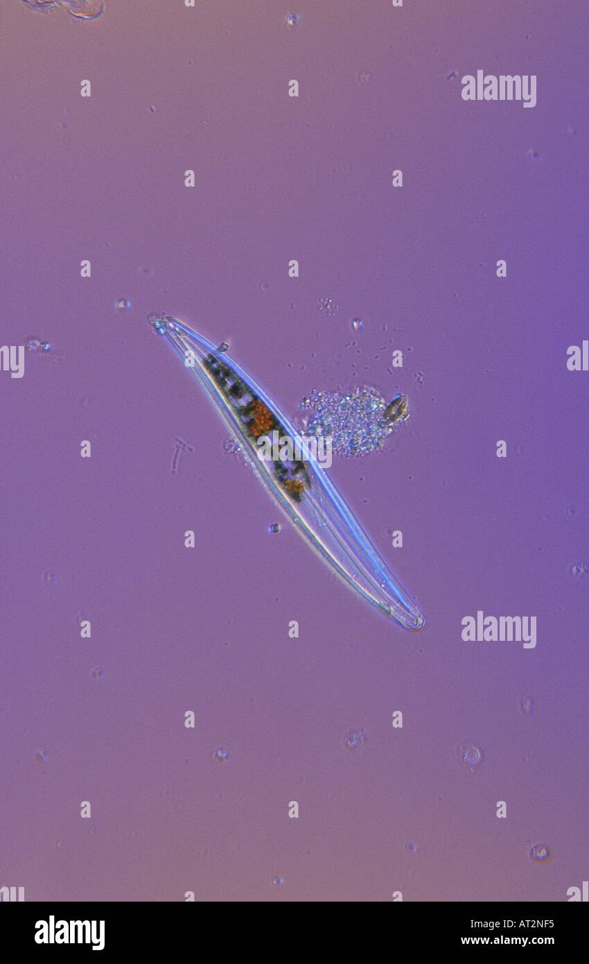 Gyrosigma Diatom Seawed Algae Optic microscopy Stock Photo - Alamy