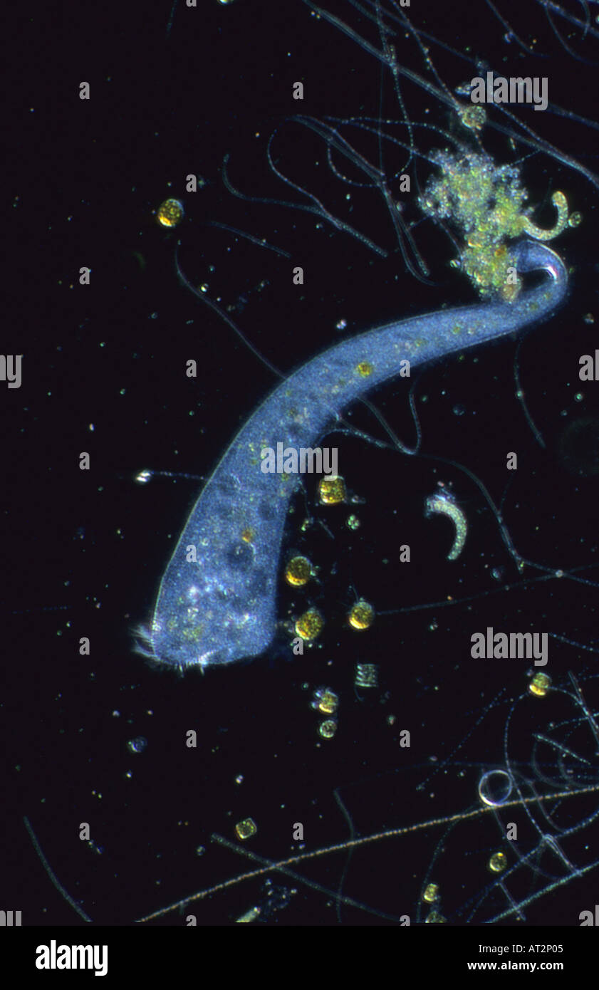 Stentor Ciliata Protozoans Optic microscopy Stock Photo - Alamy