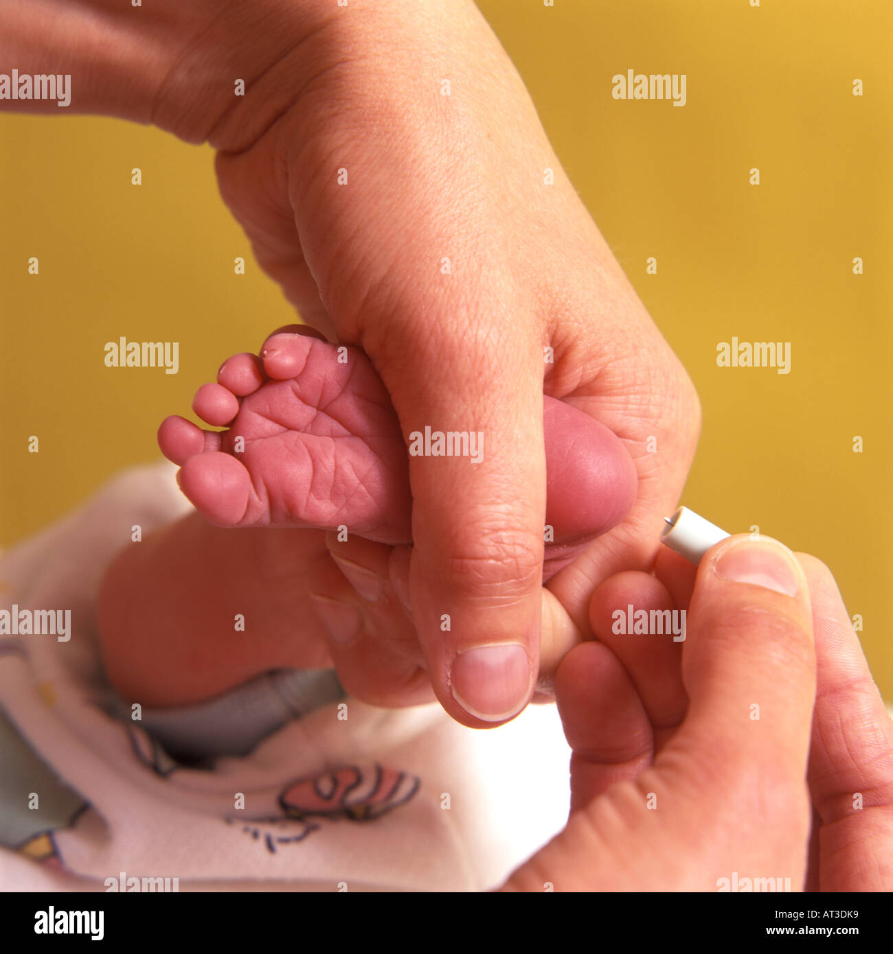 PKU Phenylketonurie Phenylketonuria Stock Photo - Alamy