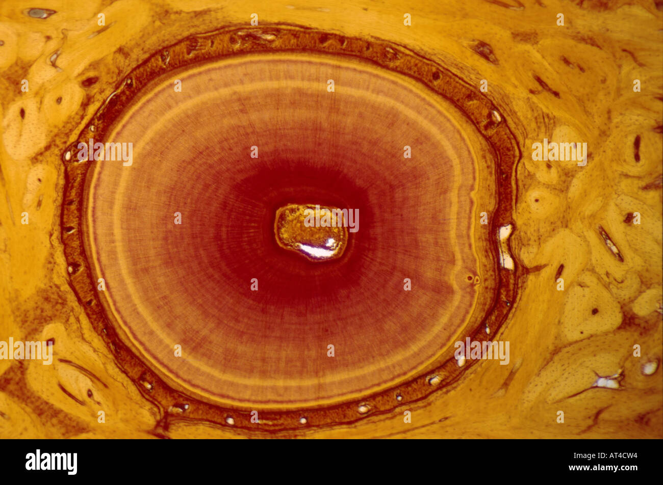 cross section through a teeth Stock Photo - Alamy