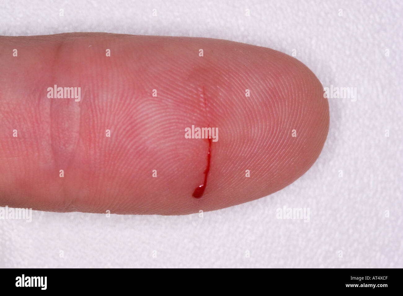 Cut and bleeding finger Stock Photo - Alamy