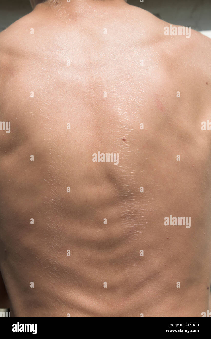 View of tensed muscles on a young man's back Stock Photo - Alamy