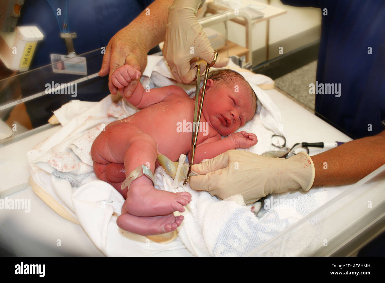 Umbilical chord hi-res stock photography and images - Alamy