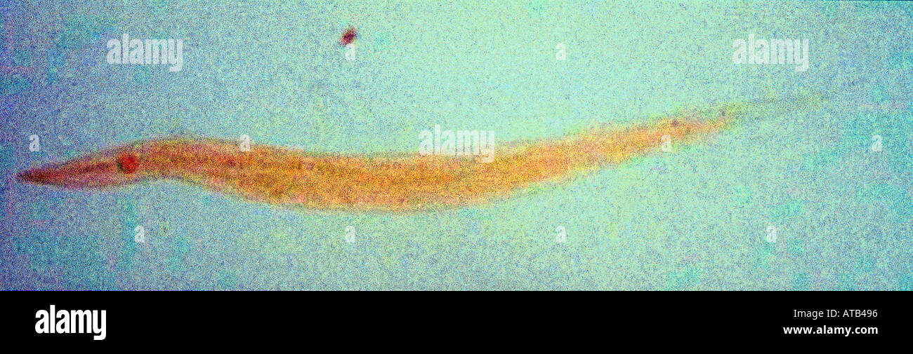 Enterobius vermicularis hi-res stock photography and images - Alamy