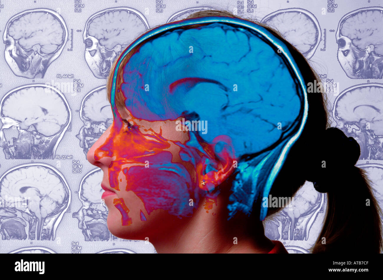 Female brain diagram hi-res stock photography and images - Alamy