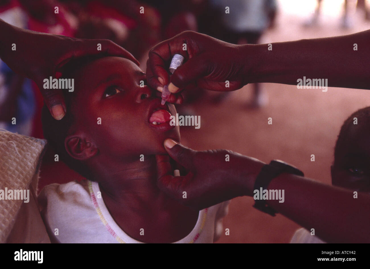 African child receives a polio vaccination at Lugufu refugee camp ...