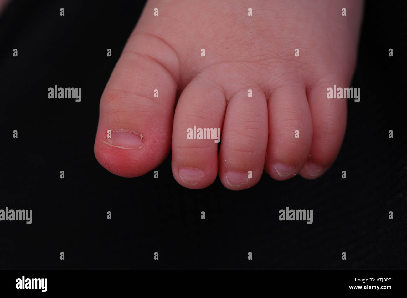 babies hand, foot Stock Photo - Alamy