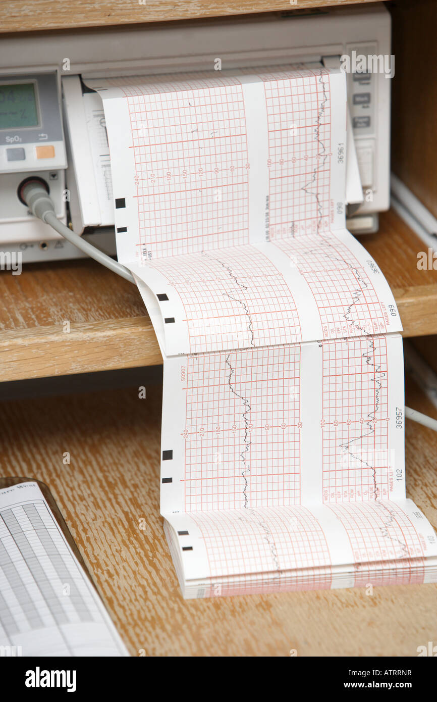 Ecg print out hi-res stock photography and images - Alamy