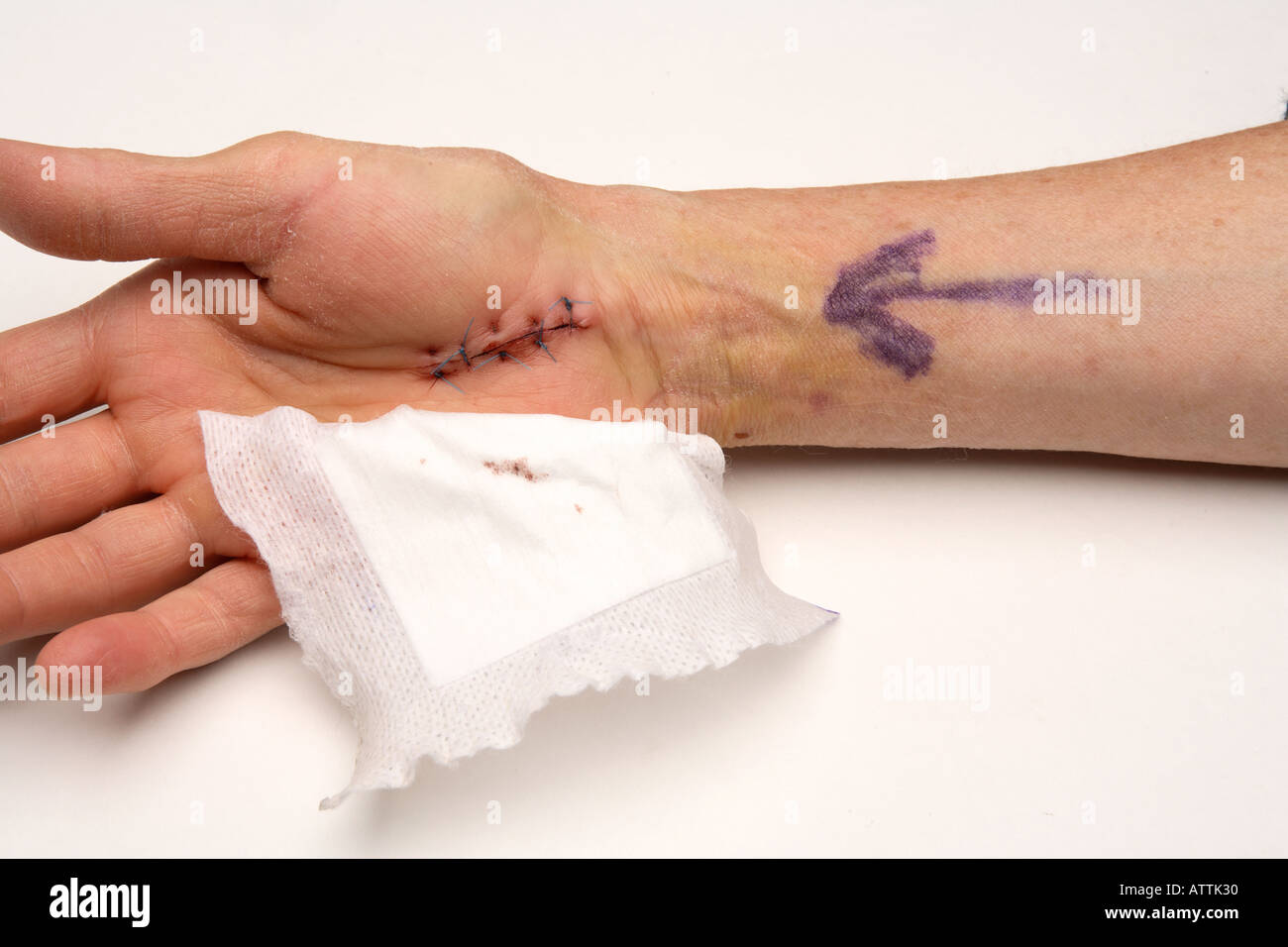 Natural pain relieving hi-res stock photography and images - Alamy